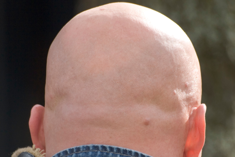 Slang For Head (20 Examples!) - Foreign Lingo