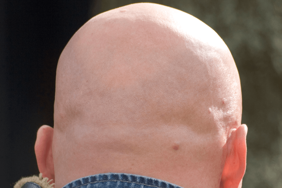 Slang For Head 20 Examples Foreign Lingo